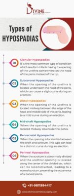 What is Hypospadias, Its Symptoms, Types, Causes, and Solution