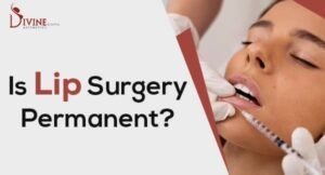 Lip Augmentation: Surgery, Fat Transfer, Fillers, Implant, Lift